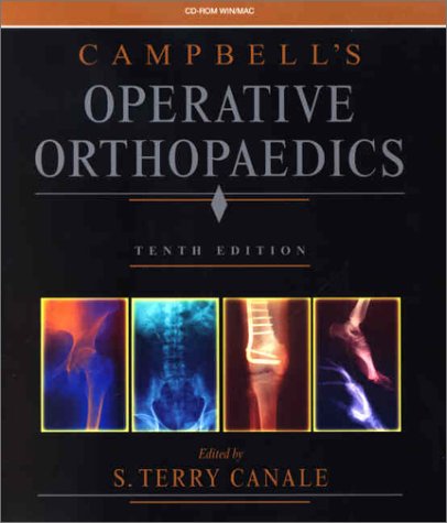 Campbell's Operative Orthopedics: 4-Volume Set Text and 4-Volume Set CD ...