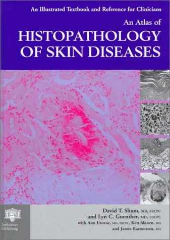 An Atlas of Histopathology of Skin Diseases: 9781850709299: Medicine ...