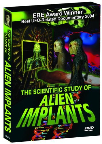 Amazon.com: The Scientific Study of Alien Implants [DVD] : Movies & TV