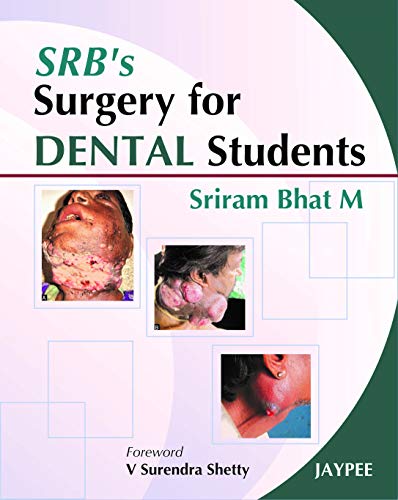 SRB'S SURGERY FOR DENTAL STUDENTS eBook : M, Sriram Bhat: Amazon.in ...