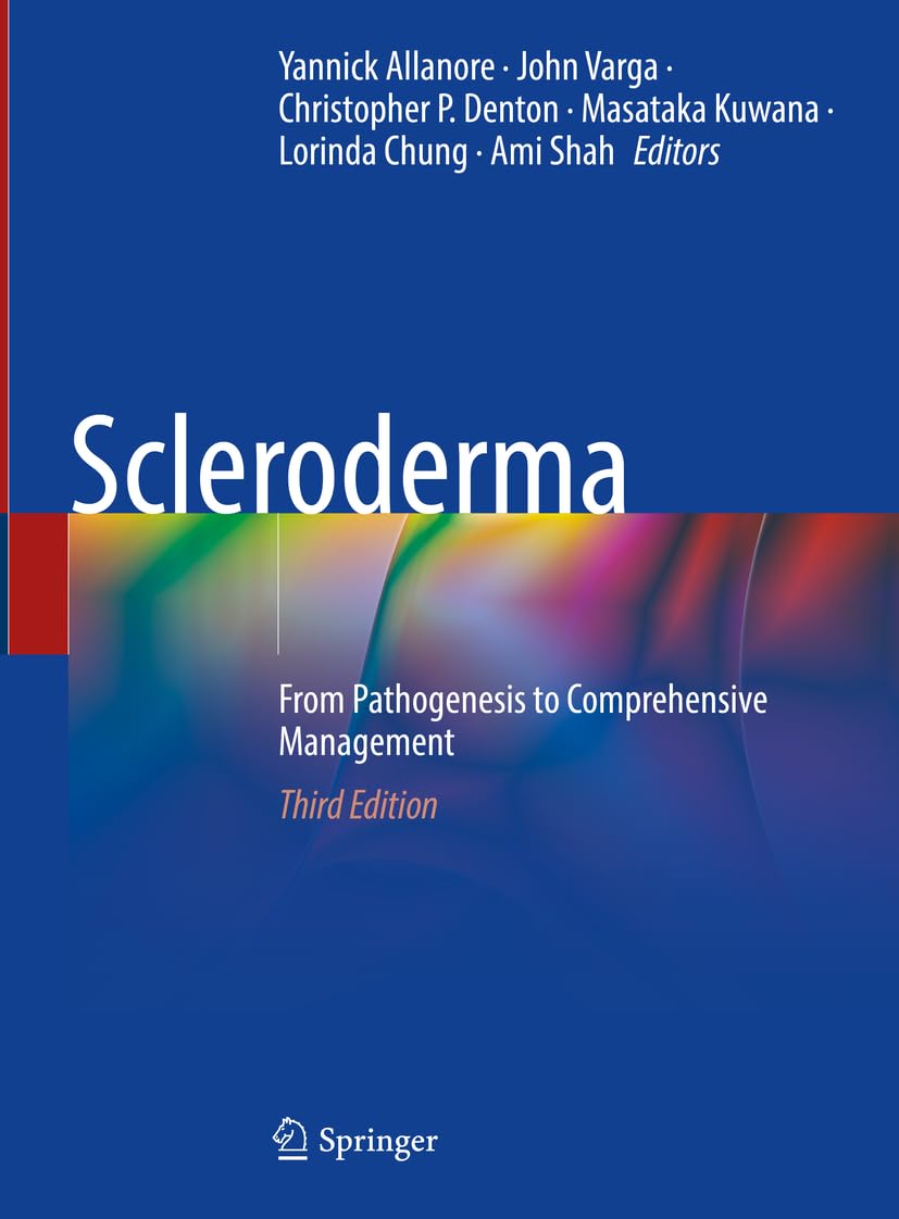 Scleroderma: From Pathogenesis to Comprehensive Management: Amazon.co ...