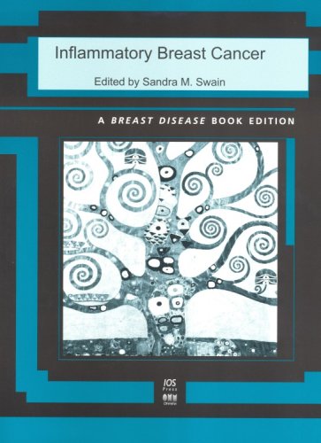 Inflammatory Breast Cancer (Breast Disease): 9781586036065: Medicine ...