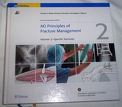 AO Principles of Fracture Management Volume 2 - Specific Fractures ...