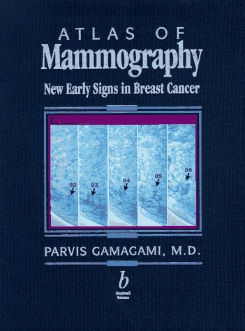 Buy Atlas of Mammography Book Online at Low Prices in India | Atlas of ...