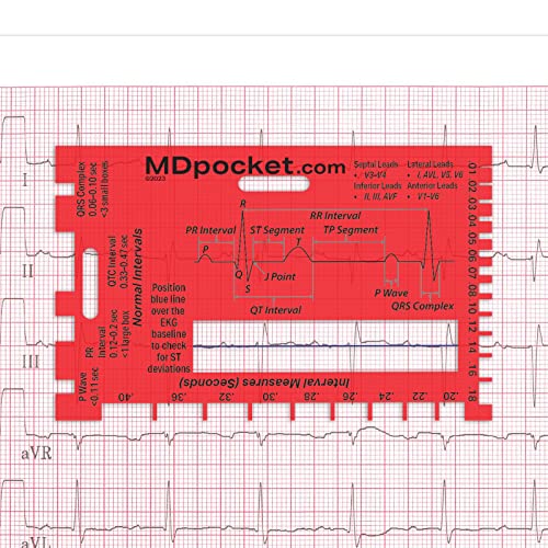 Snapklik.com : Rapid ID - EKG Intervals And Infarctions