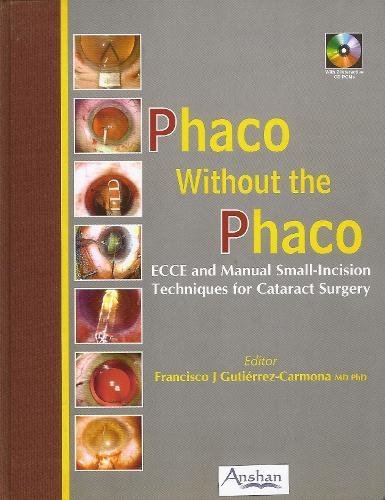 Amazon | Phaco Without the Phaco: ECCE And Manual Small-Incision ...