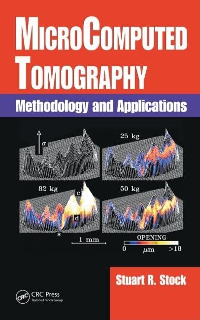 MicroComputed Tomography: Methodology and Applications: Stock, Stuart R ...
