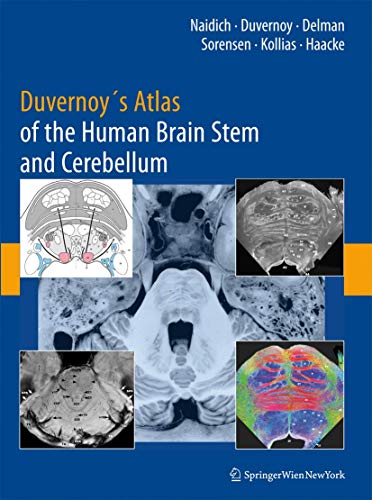 Ebook – Duvernoy’s Atlas Of The Human Brain Stem And Cerebellum 1st ...