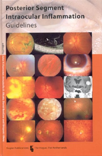 Amazon | Posterior Segment Intraocular Inflammation: Guidelines ...