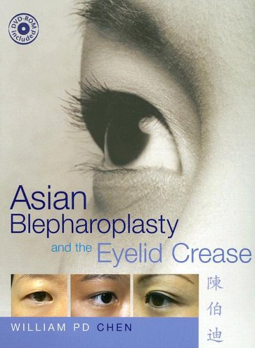 Asian Blepharoplasty and the Eyelid Crease with DVD | Amazon.com.br