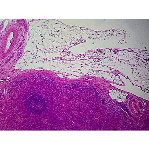 Spleen Slide Man. Spleen. Transverse Section. 64X Man Mammals