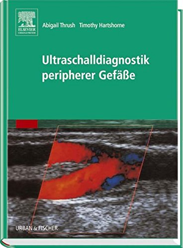 Amazon.com: Ultraschalldiagnostik peripherer Gefäße: 9783437241406 ...