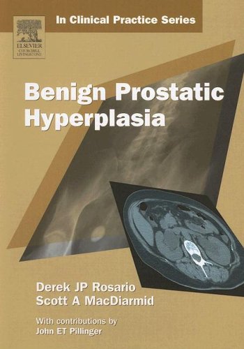 Churchill's In Clinical Practice Series: Benign Prostatic Hyperplasia ...