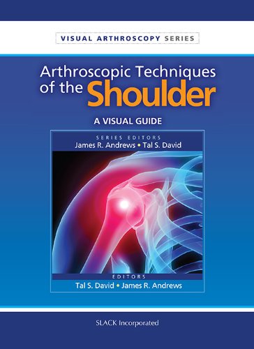 Buy Arthroscopic Techniques of the Shoulder: A Visual Guide (Visual ...