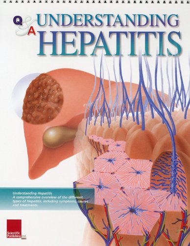 Amazon | Understanding Hepatitis Flip Chart | Scientific Publishing Ltd ...