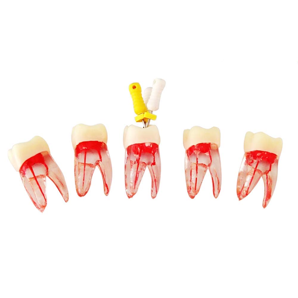 Buy Dental Root Canal Model, YOUYA DENTAL Root Canal Practice Model ...
