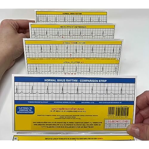 Snapklik.com : R-CAT For Arrhythmias EKG Pocket Reference Guide Plus ...
