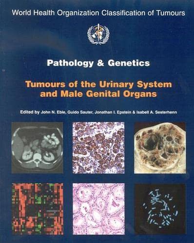 Pathology and Genetics of Tumours of the Urinary System and Male ...