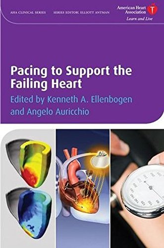 Amazon.com: Pacing to Support the Failing Heart (American Heart ...
