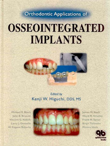 Orthodontic Applications of Osseointegrated Implants: 9780867153569 ...