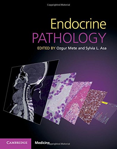 Endocrine Pathology with Online Resource: 9781107443310: Medicine ...