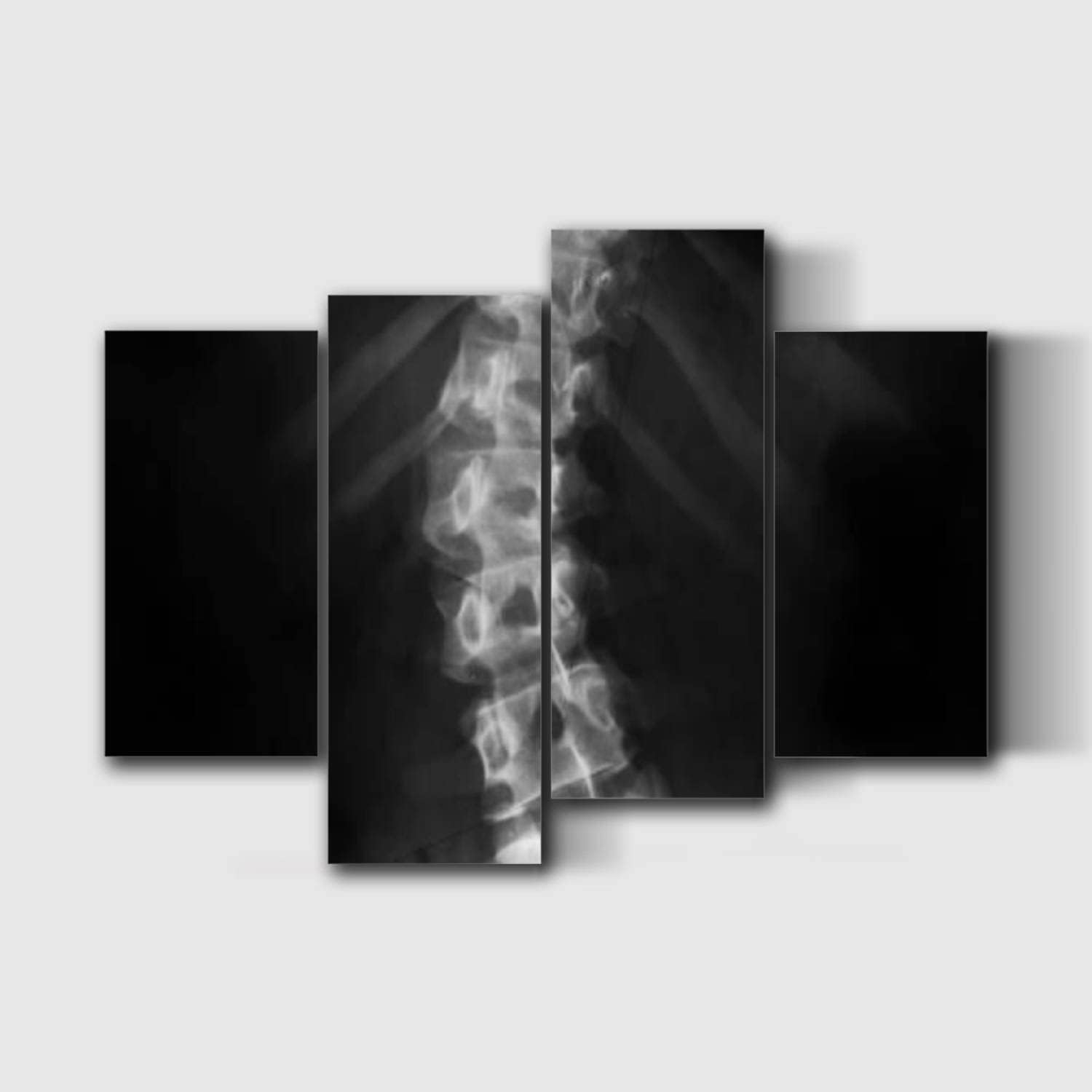 Amazon.com: UJOYAFZSIM Orthopedic Human Anatomy Medical Poster X Ray ...