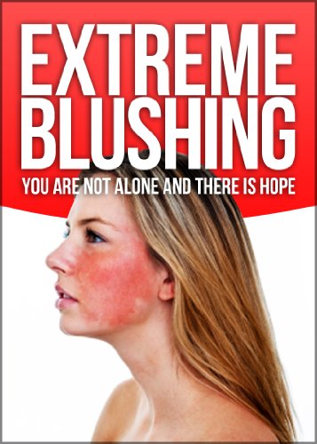 Extreme Blushing eBook : David: Amazon.co.uk: Kindle Store