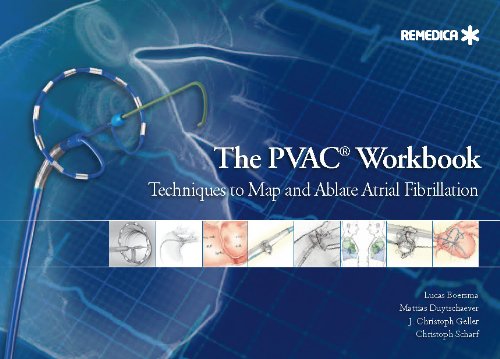 The PVAC Workbook: Techniques to Map and Ablate Atrial Fibrillation ...