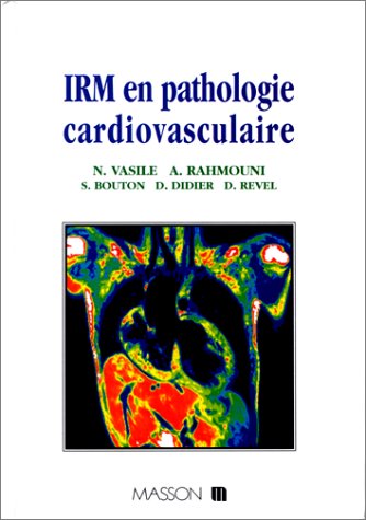 Amazon.com: IRM en pathologie cardiovasculaire: 9782225828300: Vasile ...
