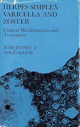 Herpes Simplex Varicella and Zoster: Clinical Manifestations and ...