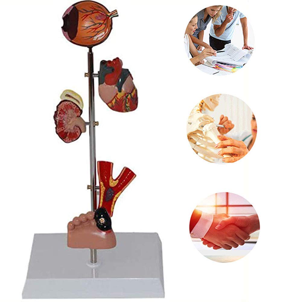 Buy DBSCD Human Organ Dissection Model, es Pathology Model-5 Parts ...