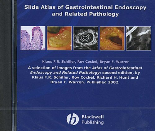 Slide Atlas of Gastrointestinal Endoscopy and Related Pathology: Cd–rom ...