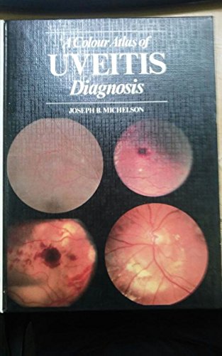 Colour Atlas of Uveitis Diagnosis, A: Amazon.co.uk: Michelson, Joseph B ...