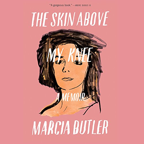 Amazon.com: The Skin Above My Knee (Audible Audio Edition): Marcia ...
