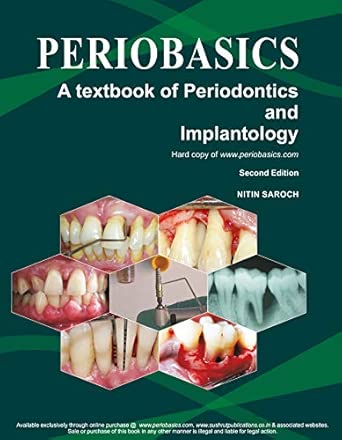 Periobasics: A textbook of Periodontics and Implantology : Nitin Saroch ...