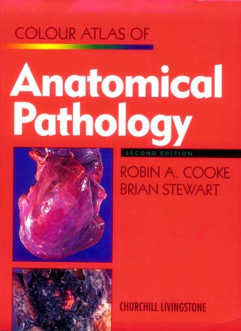 Colour Atlas of Anatomical Pathology : Cooke, Robin A., Stewart, Brian ...