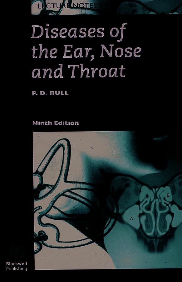 Lecture Notes on Diseases of the Ear, Nose and Throat: 9780632065066 ...