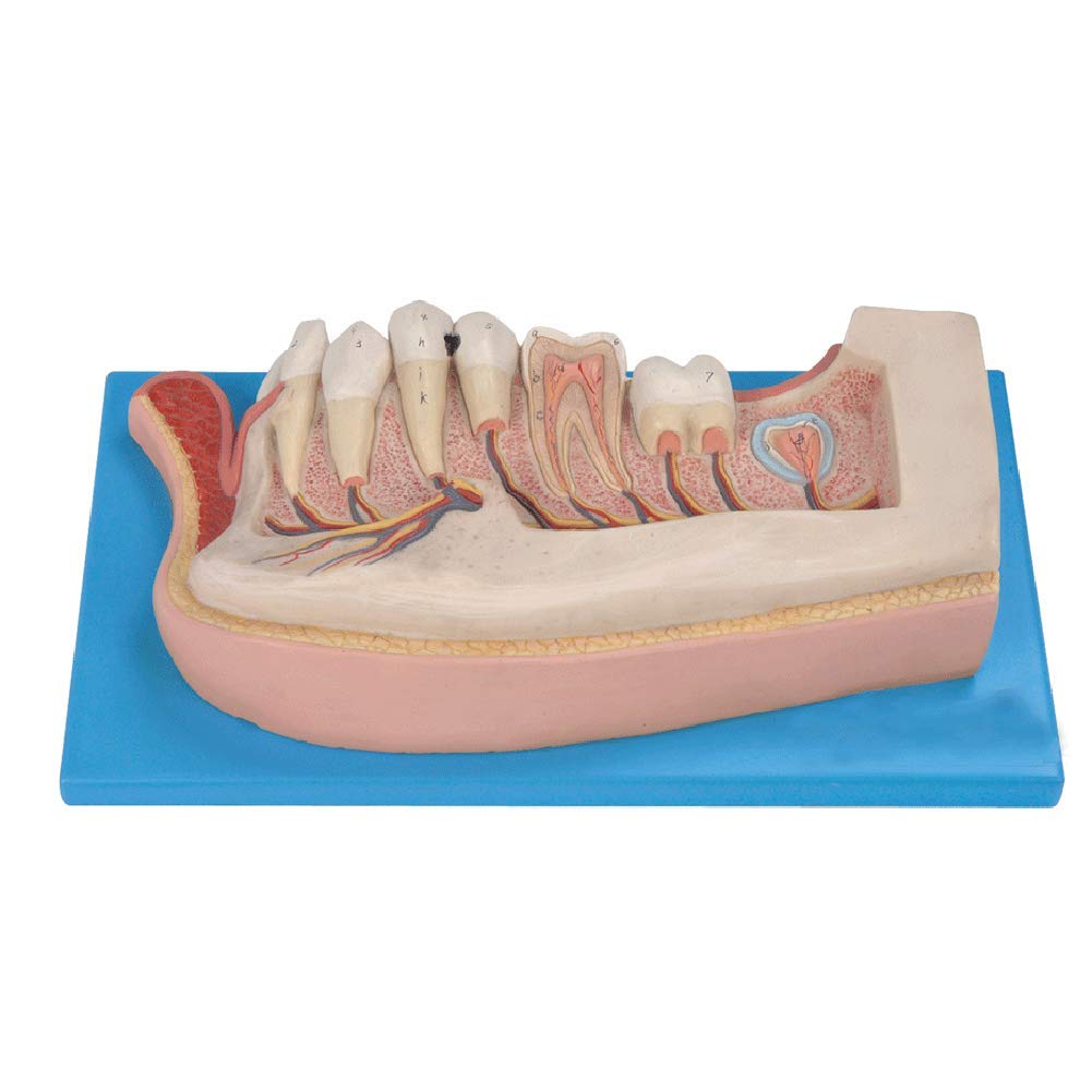 Buy XIEJI Child Dentition Model Mandibular Tooth Dental Teeth Caries ...