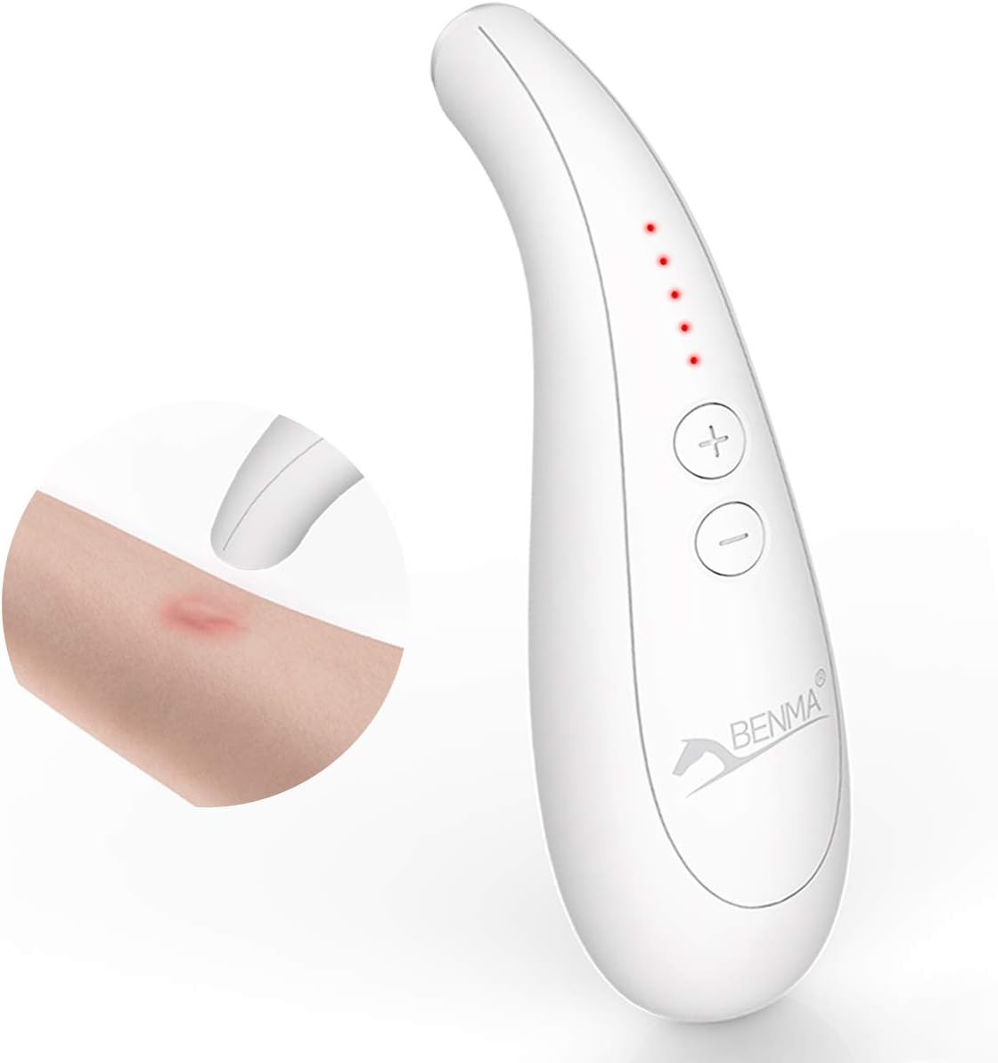Amazon.com: Aixoxo Bite and Sting Electronic Helper,Easy to use,Instant Itch Relief Reduces Pain ...