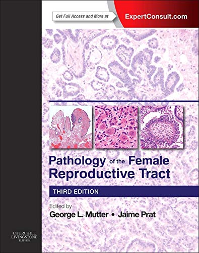 Pathology of the Female Reproductive Tract (Expert Consult ...