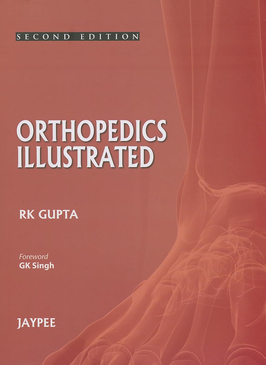Orthopedics Illustrated: 9789350251096: Medicine & Health Science Books ...