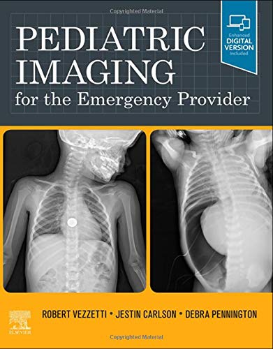 Pediatric Imaging for the Emergency Provider: 9780323708494: Medicine ...