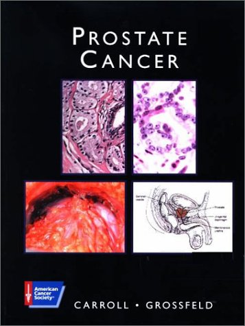 Prostate Cancer (American Cancer Society Atlas of Clinical Oncology ...