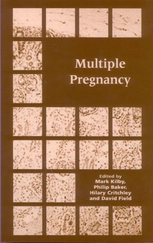 Multiple Pregnancy: Amazon.co.uk: Kilby, Mark D., Baker, Philip, Critchley, Hilary ...
