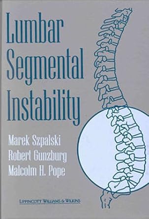 Lumbar Segmental Instability: 9780781719063: Medicine & Health Science ...