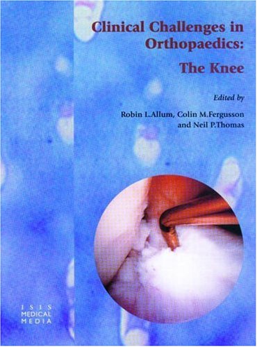 Clinical Challenges in Orthopaedics: The Knee: 9781899066636: Medicine ...