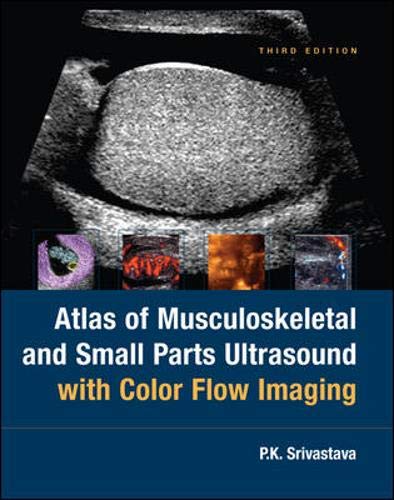 Atlas Of Musculoskeletal and Small Parts Ultrasound with Color Flow ...