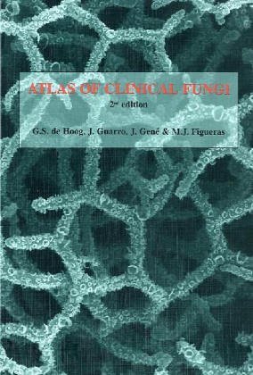 Atlas of Clinical Fungi: 9789070351434: Medicine & Health Science Books ...