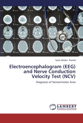 Electroencephalogram (Eeg) and Nerve Conduction Velocity Test (NCV ...