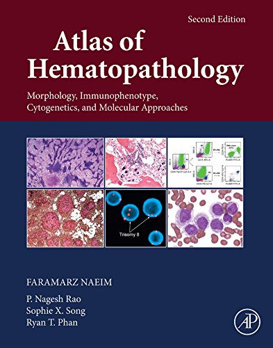 Amazon | Atlas of Hematopathology: Morphology, Immunophenotype ...